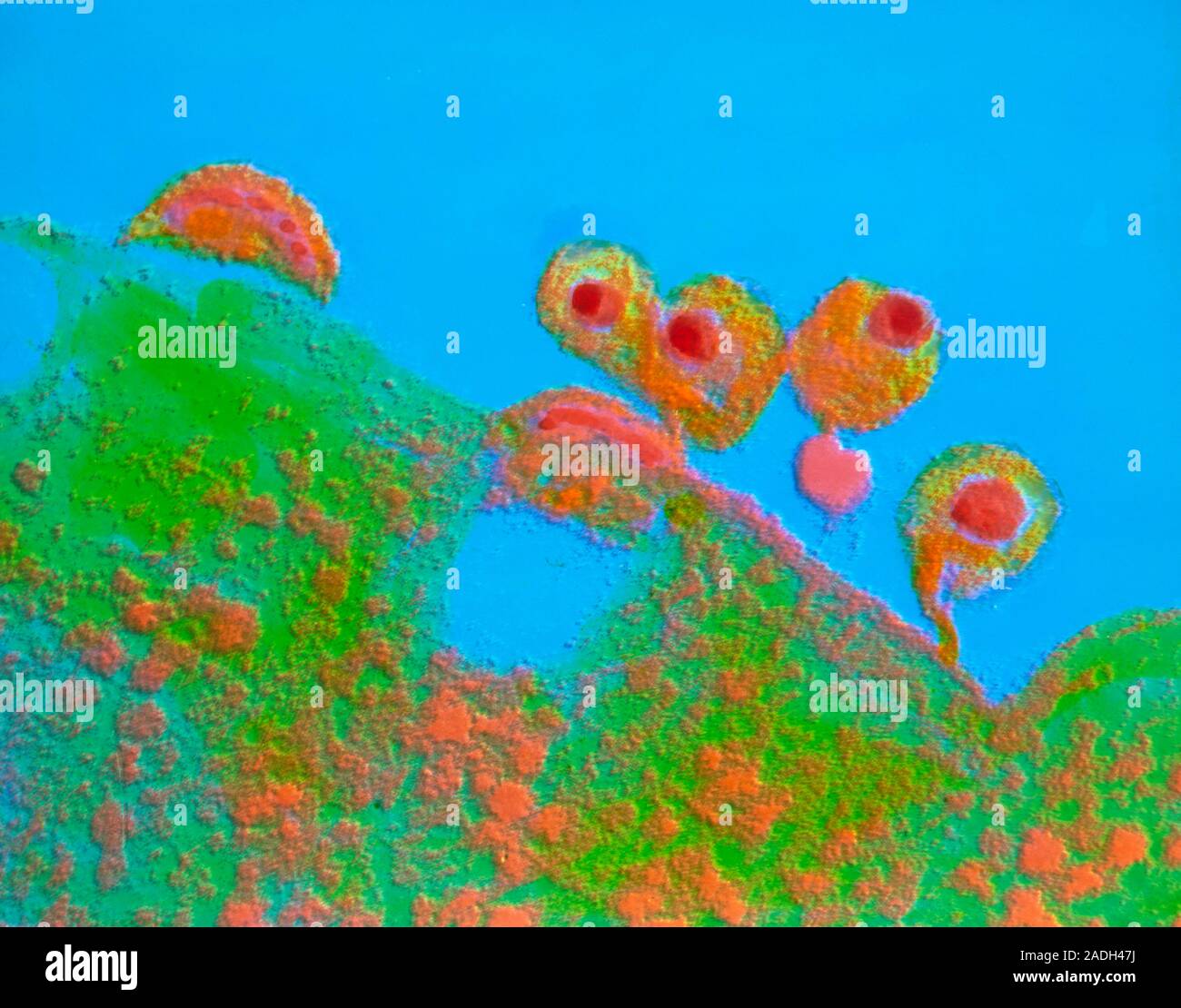 False-colour transmission electron micrograph (TEM) of AIDS virus ...