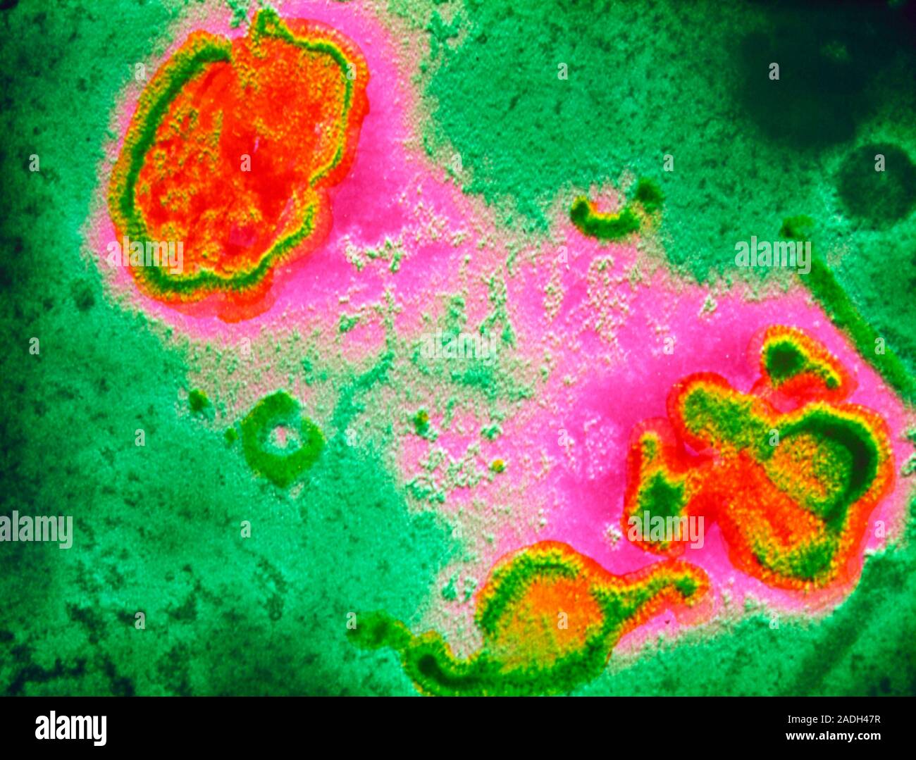 False colour transmission electron micrograph (TEM) of virions (virus ...