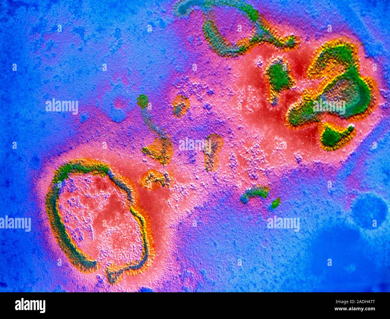 False-colour transmission electron micrograph (TEM) of virions, or ...