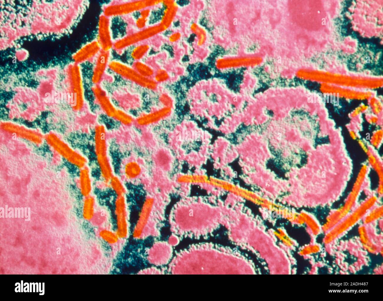 Parainfluenza type 1 virus. Coloured transmission electron micrograph (TEM) of many virus ...