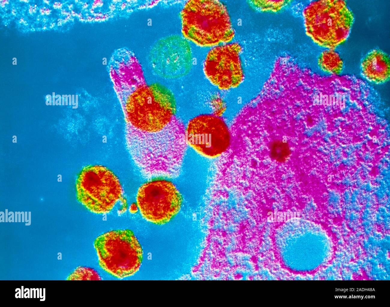 Transmission electron micrograph (TEM) of AIDS virus particles ...