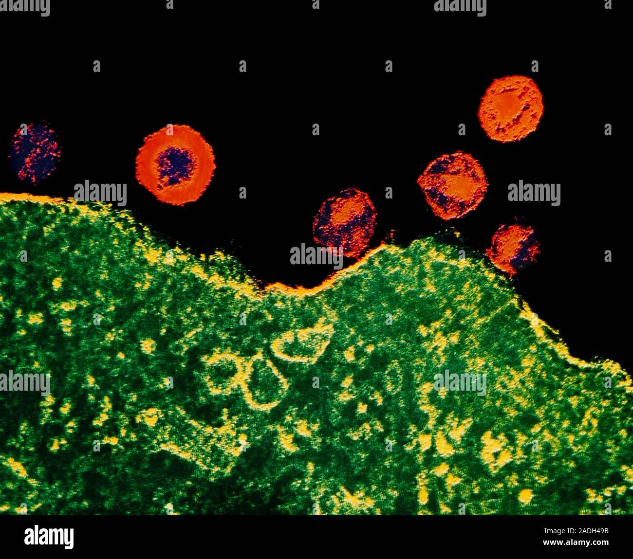 False-colour transmission electron micrograph (TEM) showing AIDS virus ...