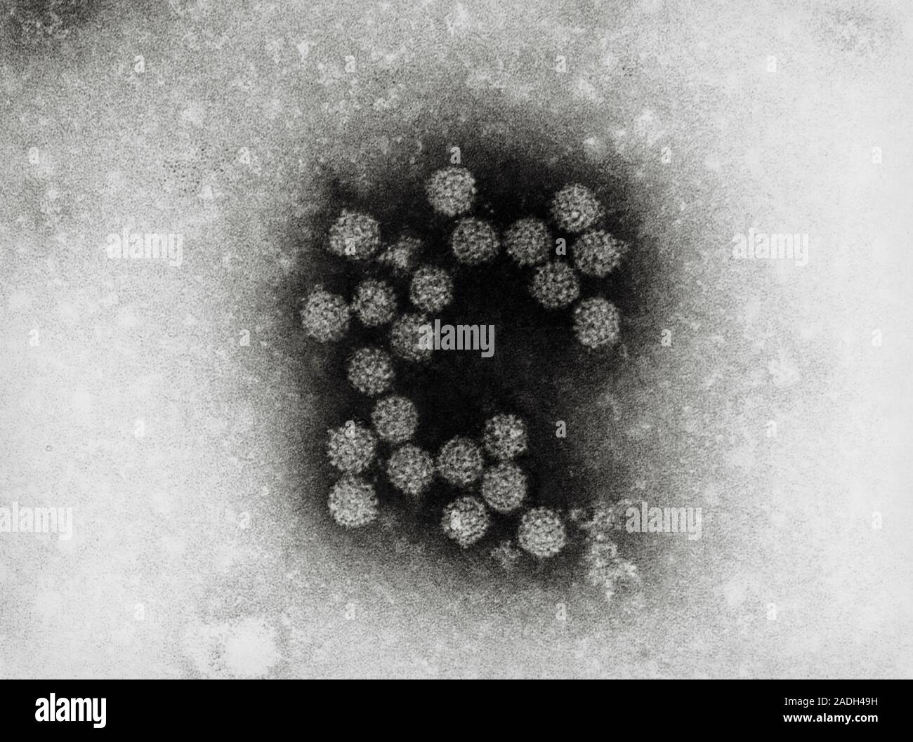 Transmission electron micrograph of virus particles of the ...
