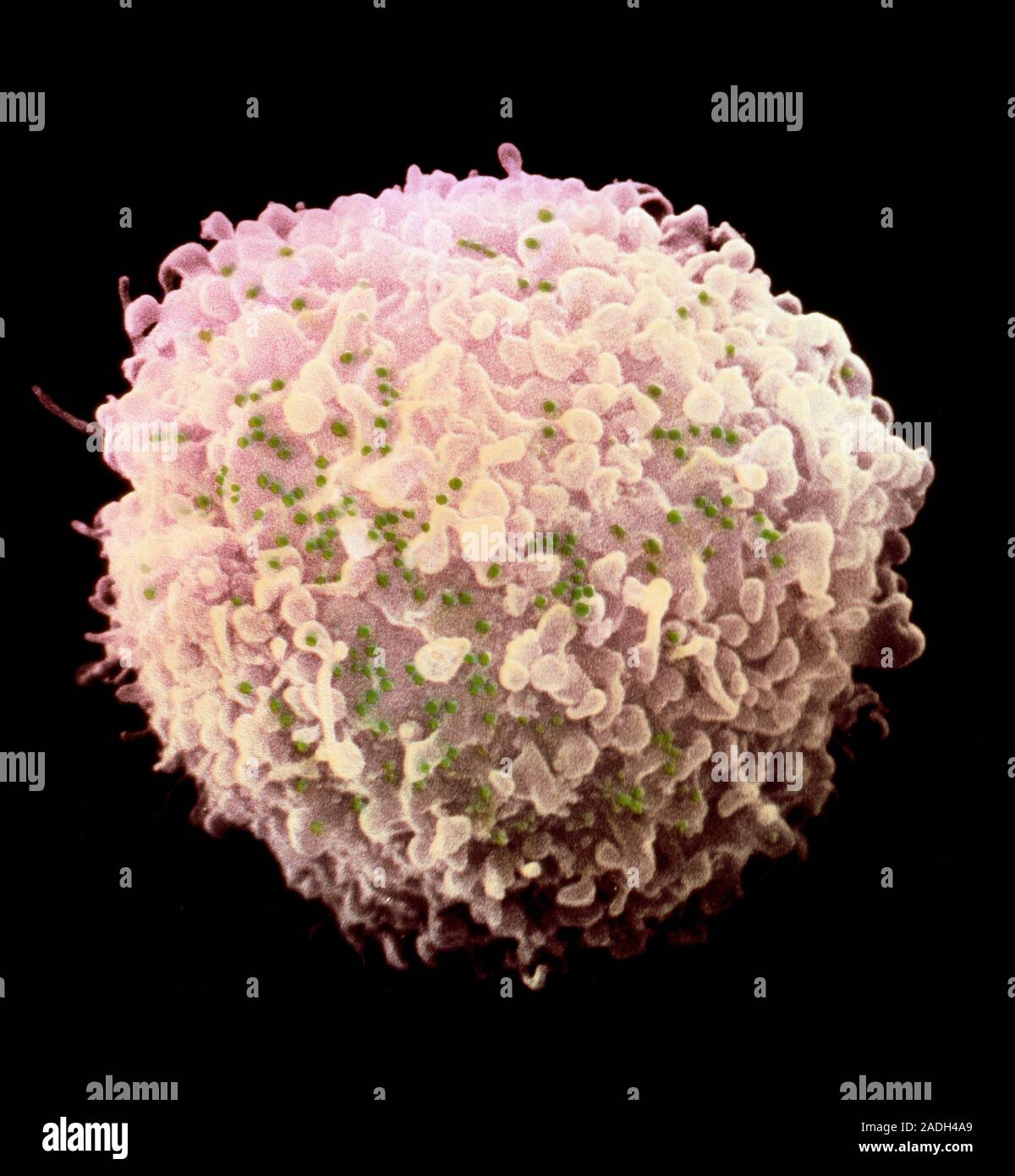 AIDS. False-colour scanning electron micrograph of a T-lymphocyte ...