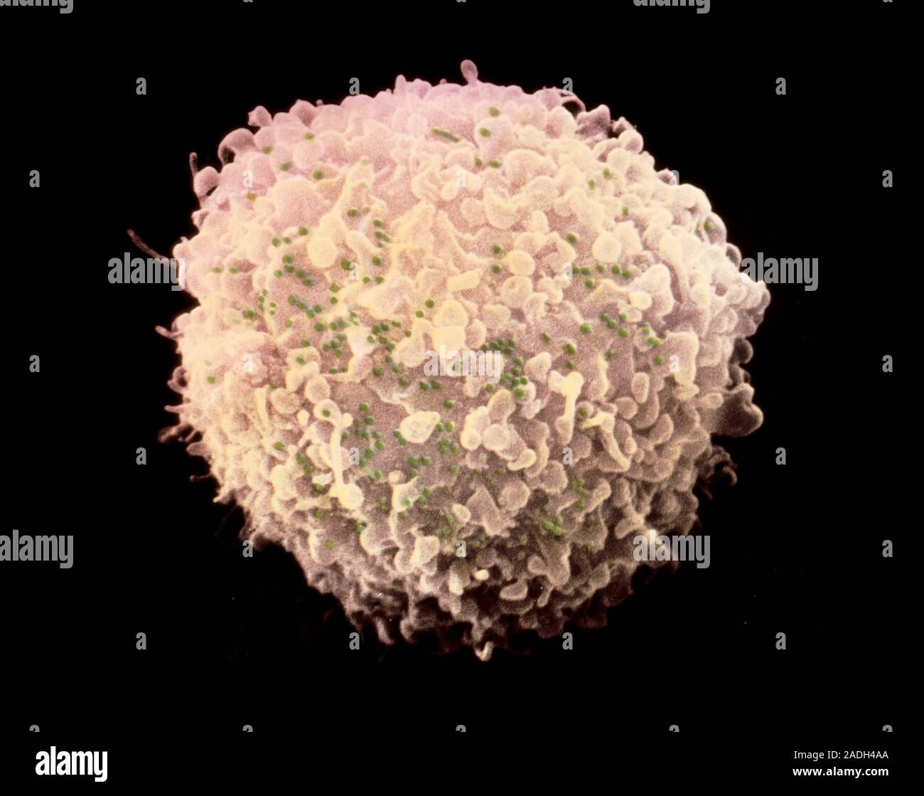 AIDS. False-colour scanning electron micrograph of a T-lymphocyte ...