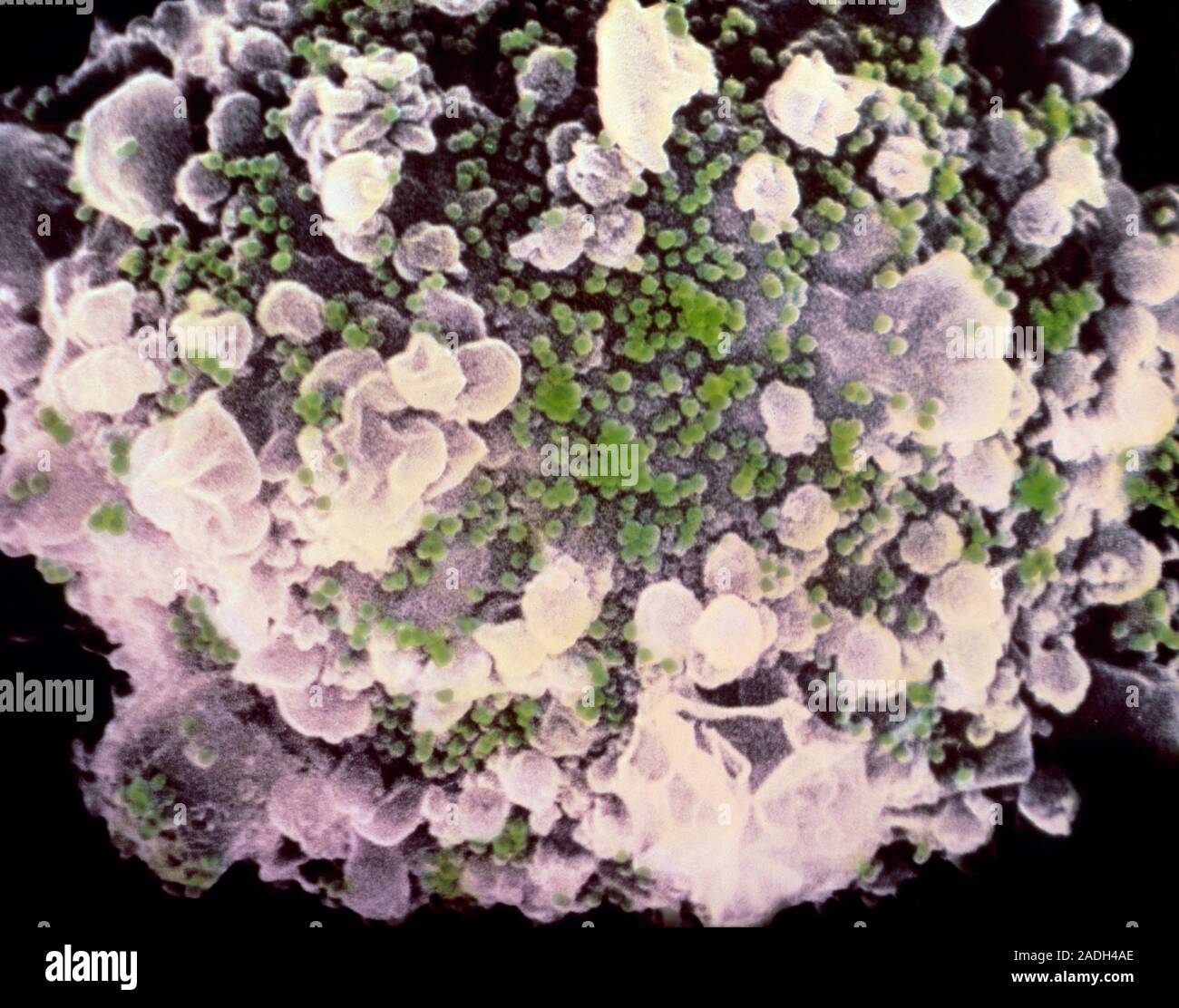 AIDS. False-colour scanning electron micrograph of a T-lymphocyte ...