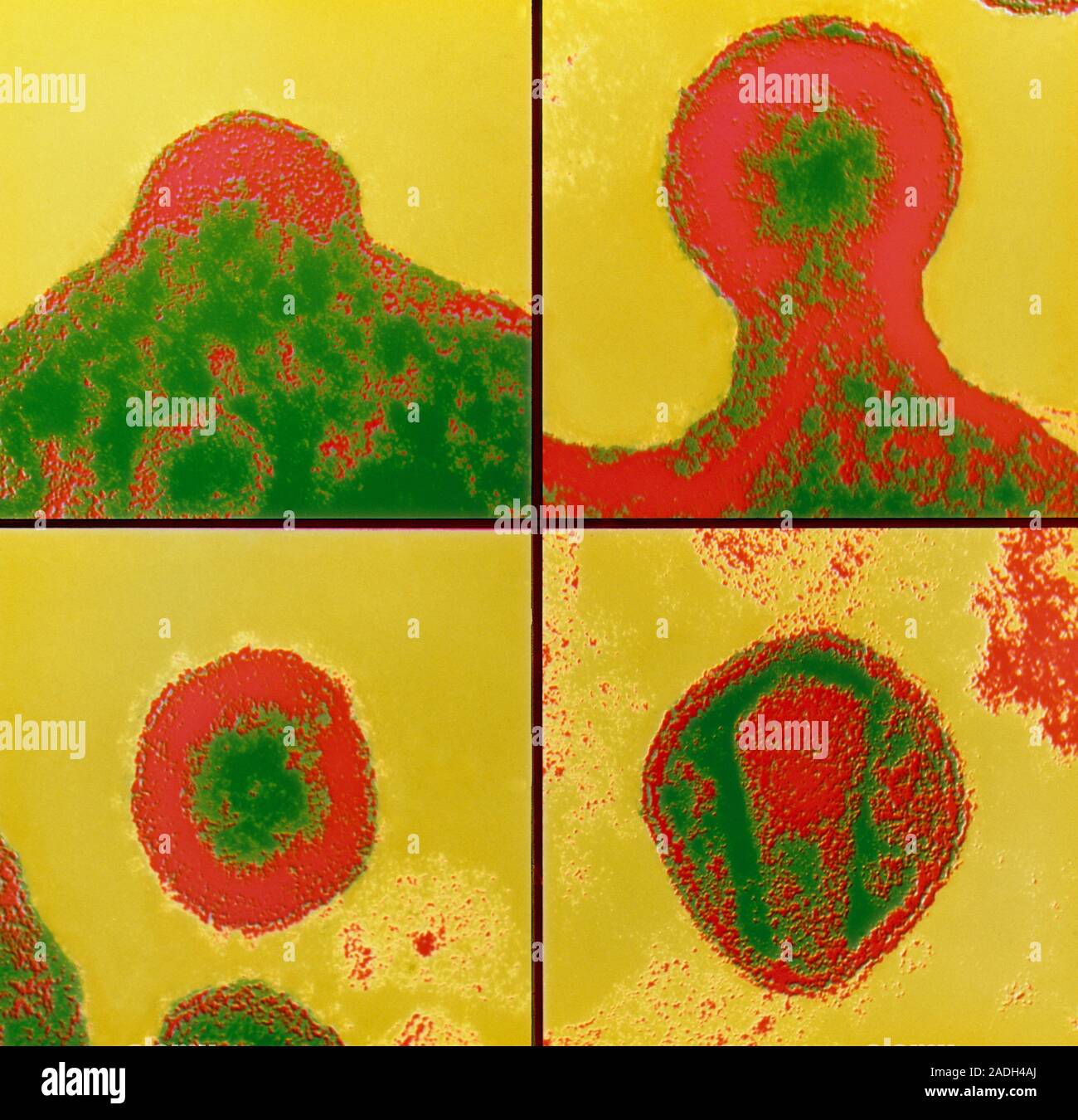 Formation of an AIDS virus particle. The sequence of false-colour ...