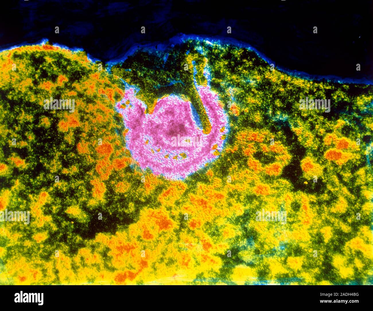 False-colour transmission electron micrograph of a Human ...