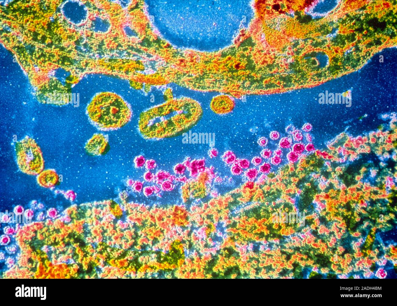 False-colour transmission electron micrograph (TEM) of virions (virus ...