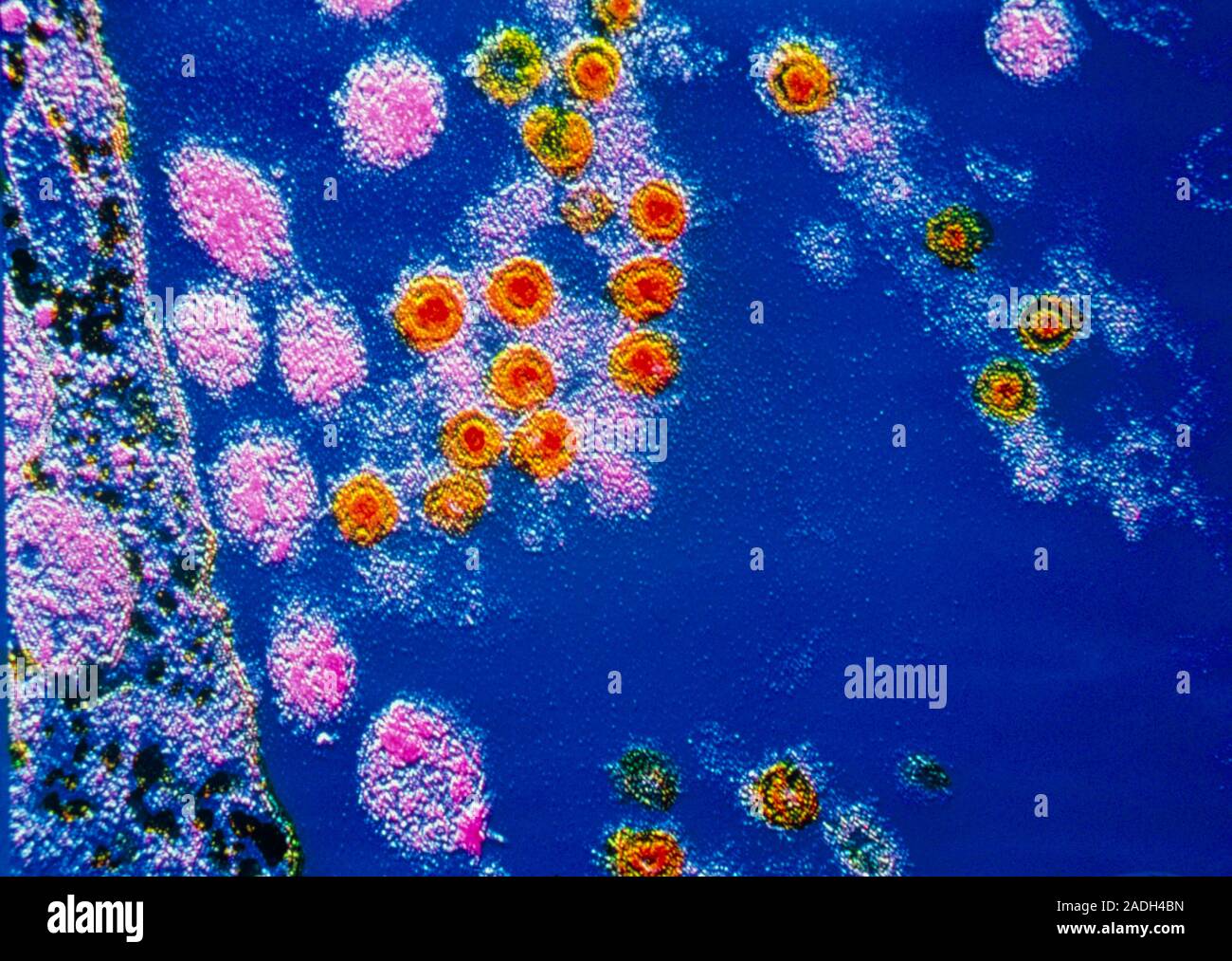 False-colour transmission electron micrograph (TEM) of virions (virus ...