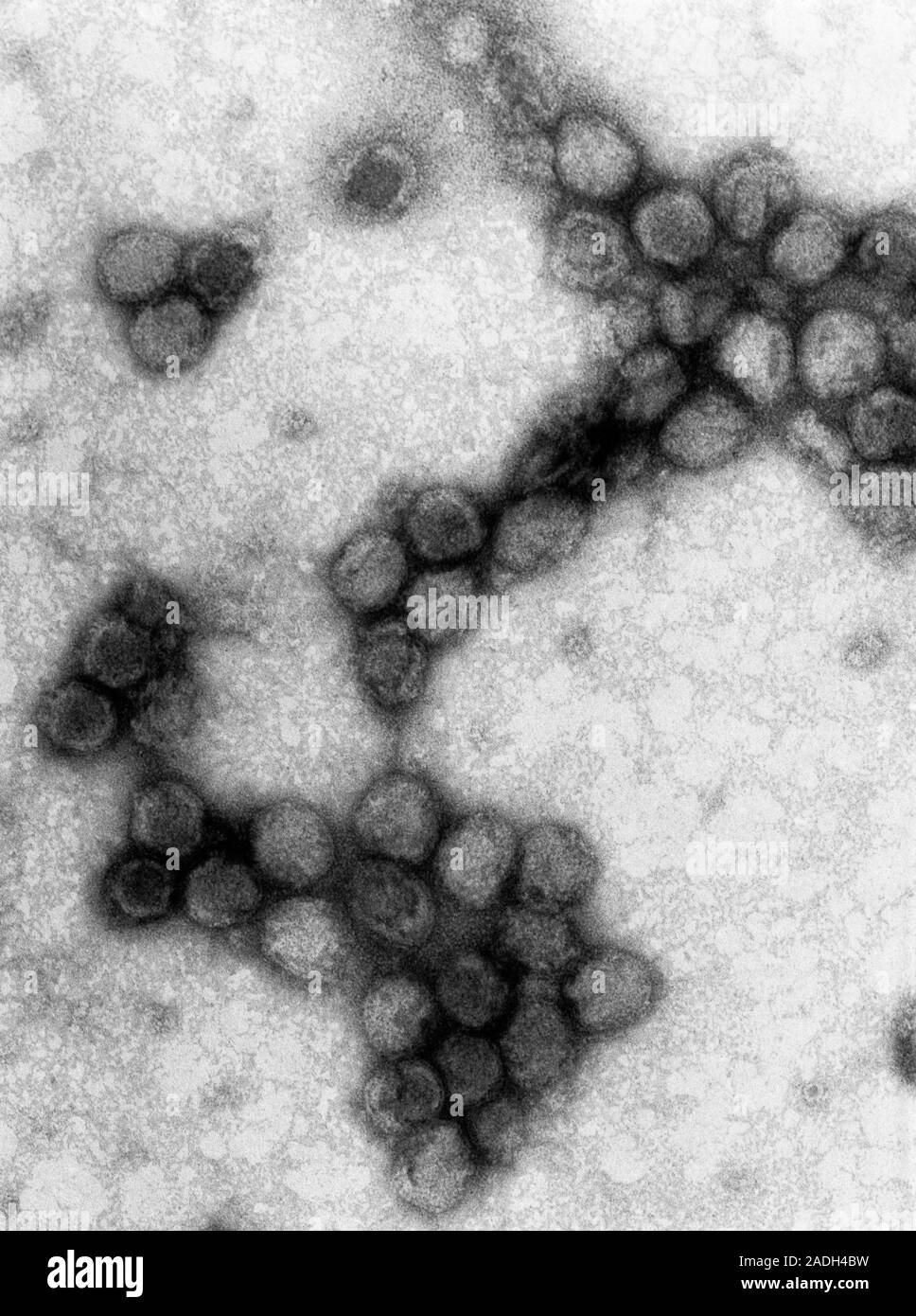 Transmission electron micrograph of tick-borne encephalitis virus, one ...