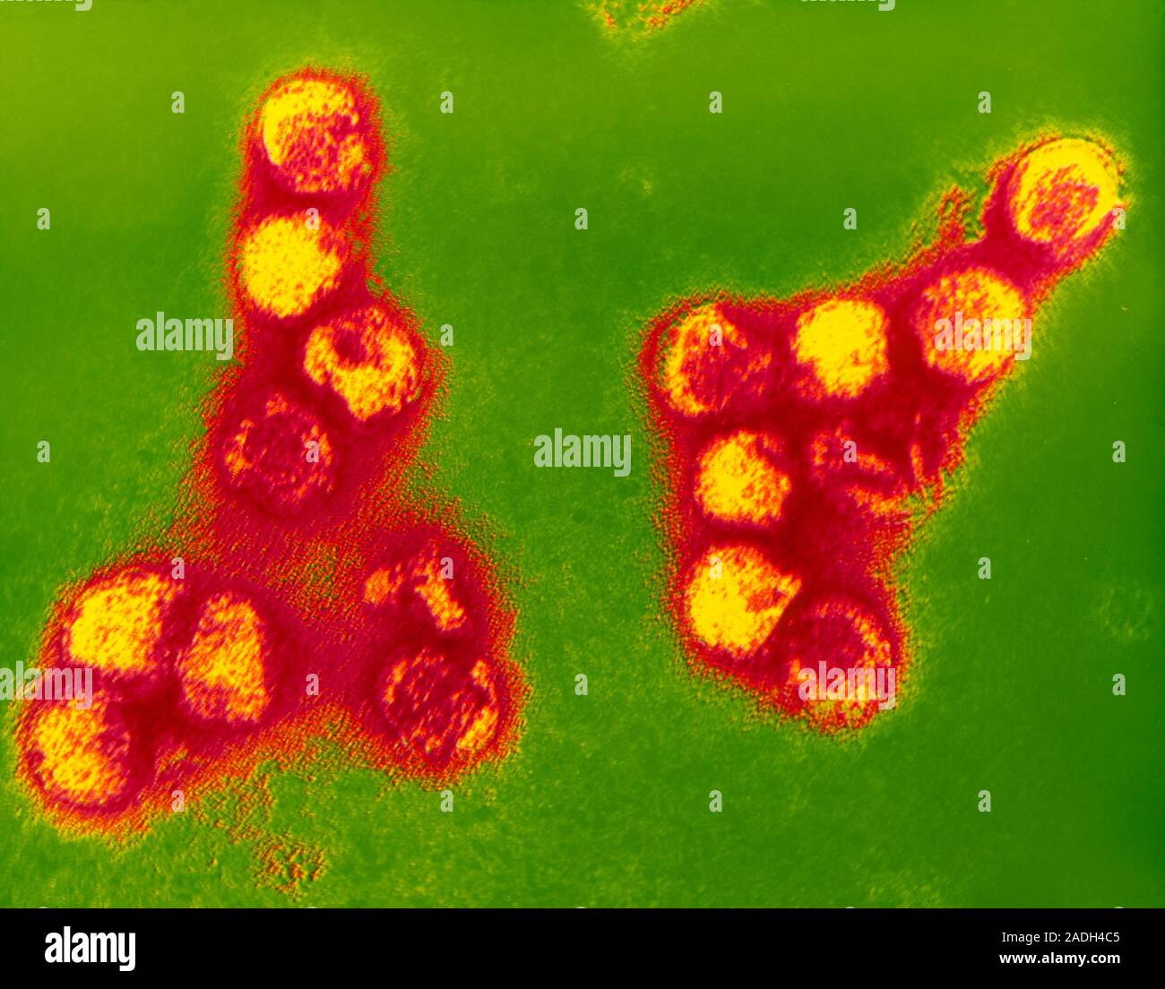 False-colour transmission electron micrograph of tick-borne ...