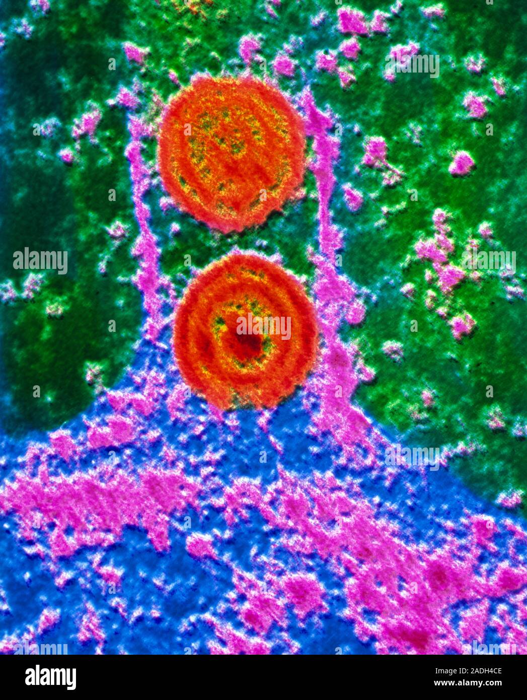 Herpes simplex virus (HSV): false-colour transmission electron ...
