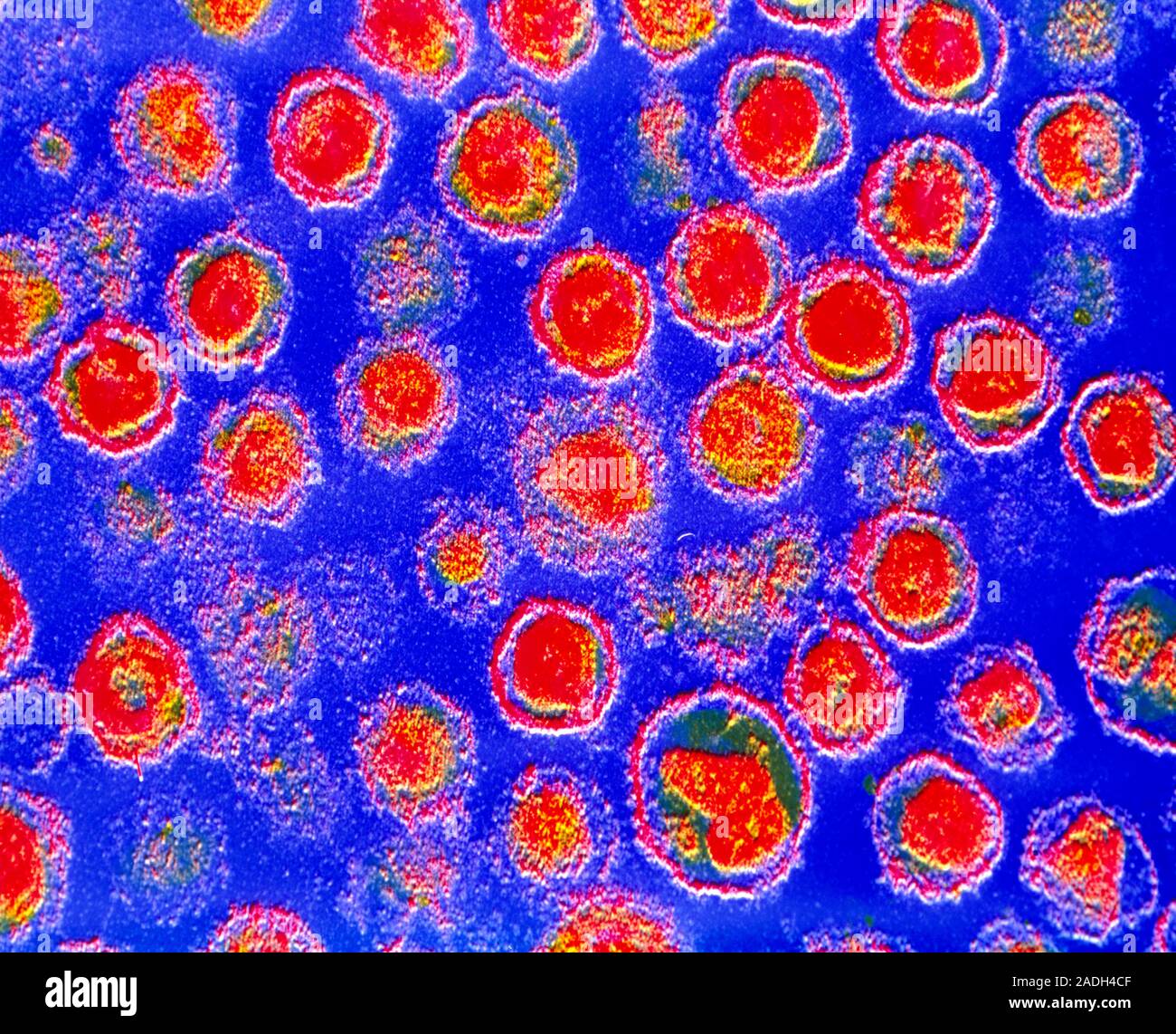 False-colour transmission electron micrograph (TEM) of virions (virus ...