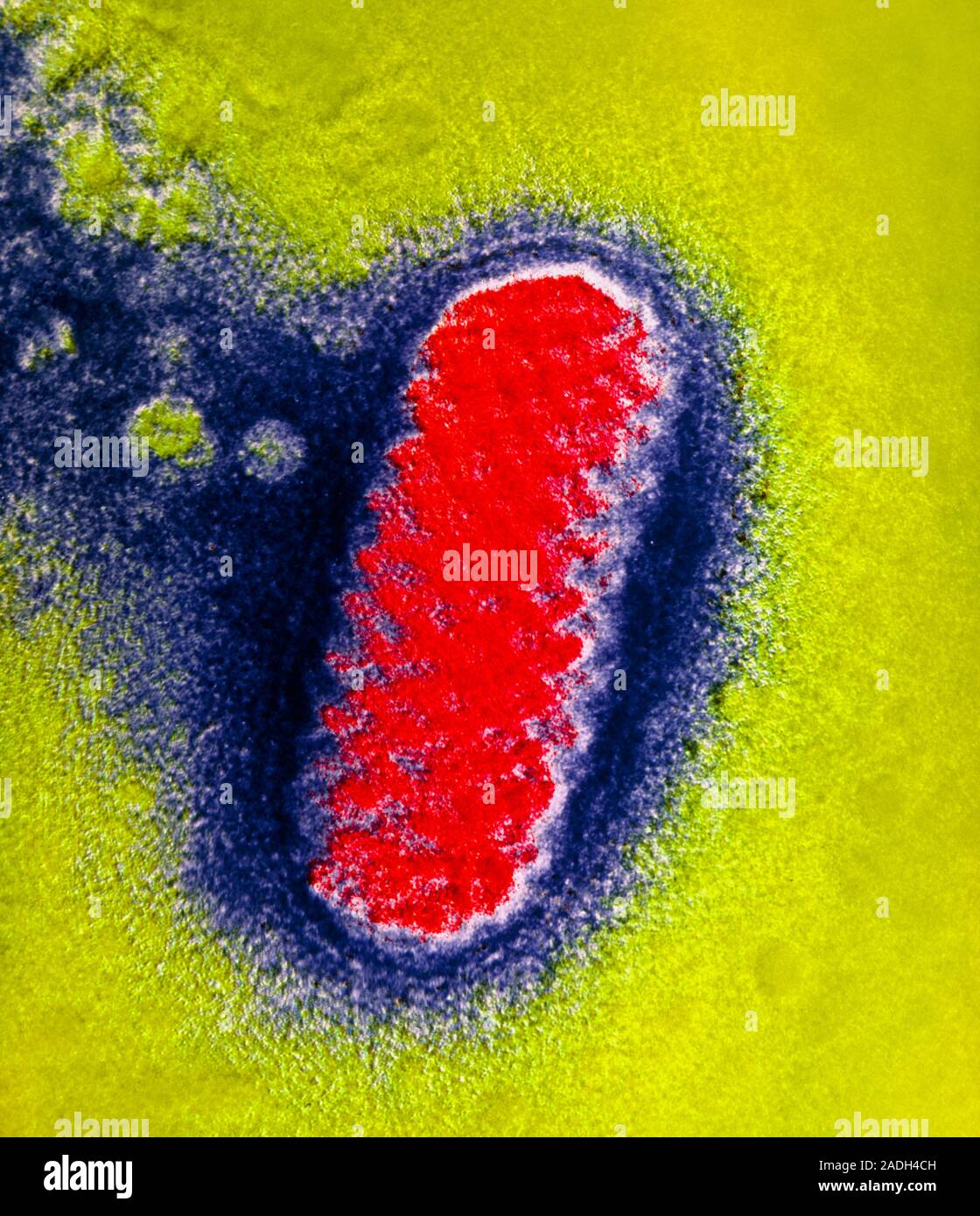False-colour transmission electron micrograph of the orf virus, a brick ...