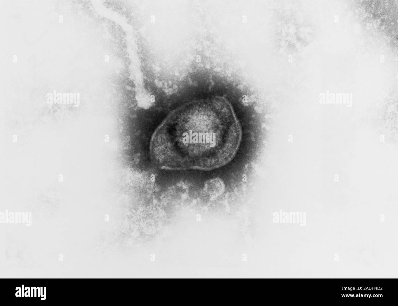 Transmission electron micrograph (TEM) of a Herpes simplex virus. The ...