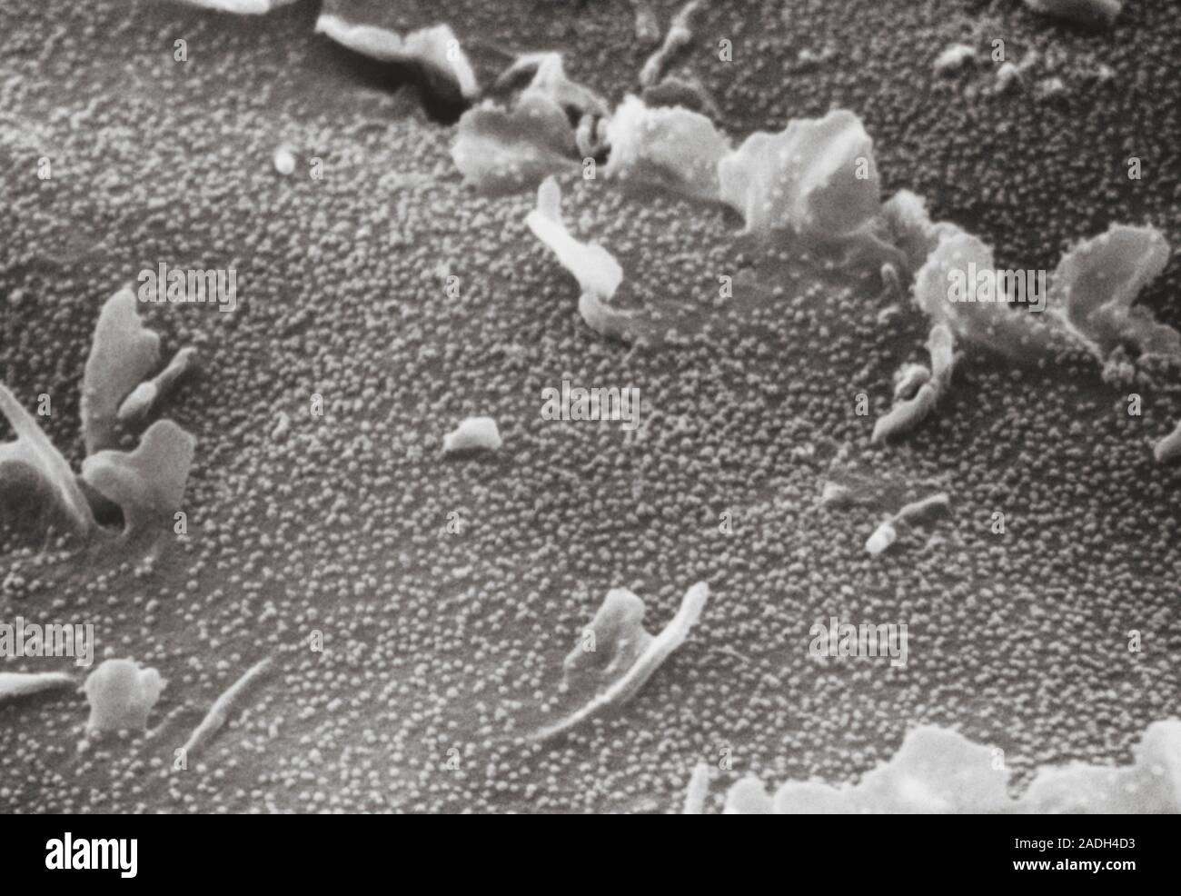 Scanning electron micrograph of rubella viruses erupting as dots from ...