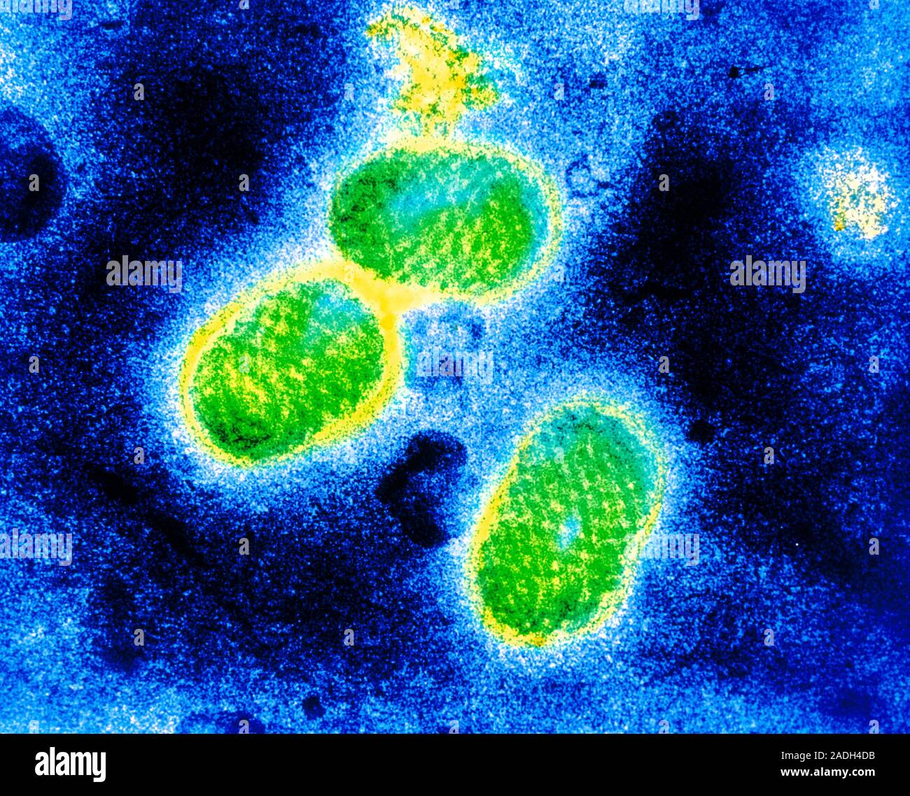 False-colour transmission electron micrograph (TEM) of viruses of the ...