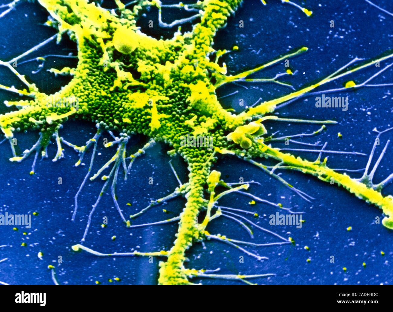 False-colour scanning electron micrograph (SEM) of a cell fibroblast ...