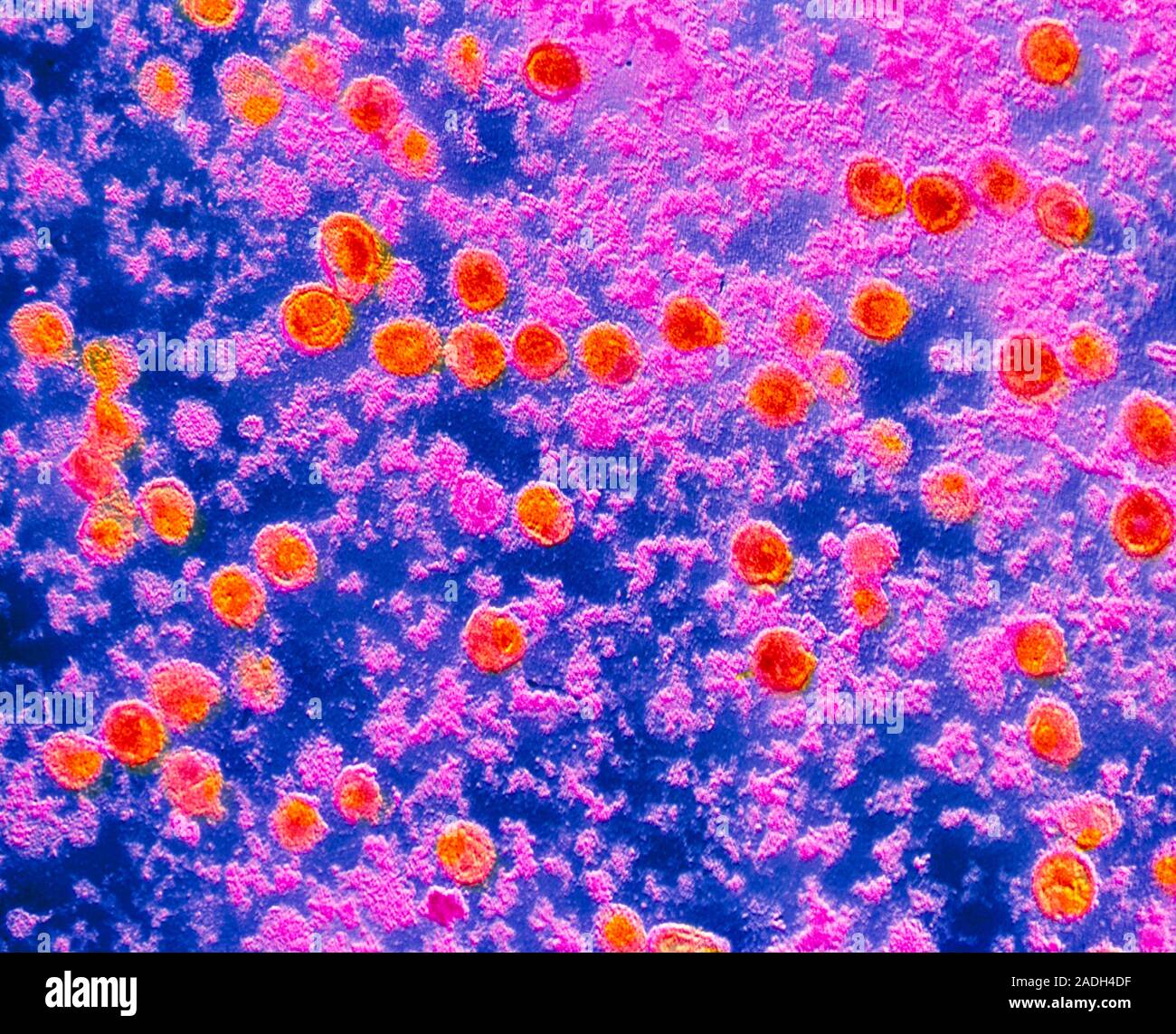 False-colour transmission electron micrograph (TEM) of Human T-Cell ...