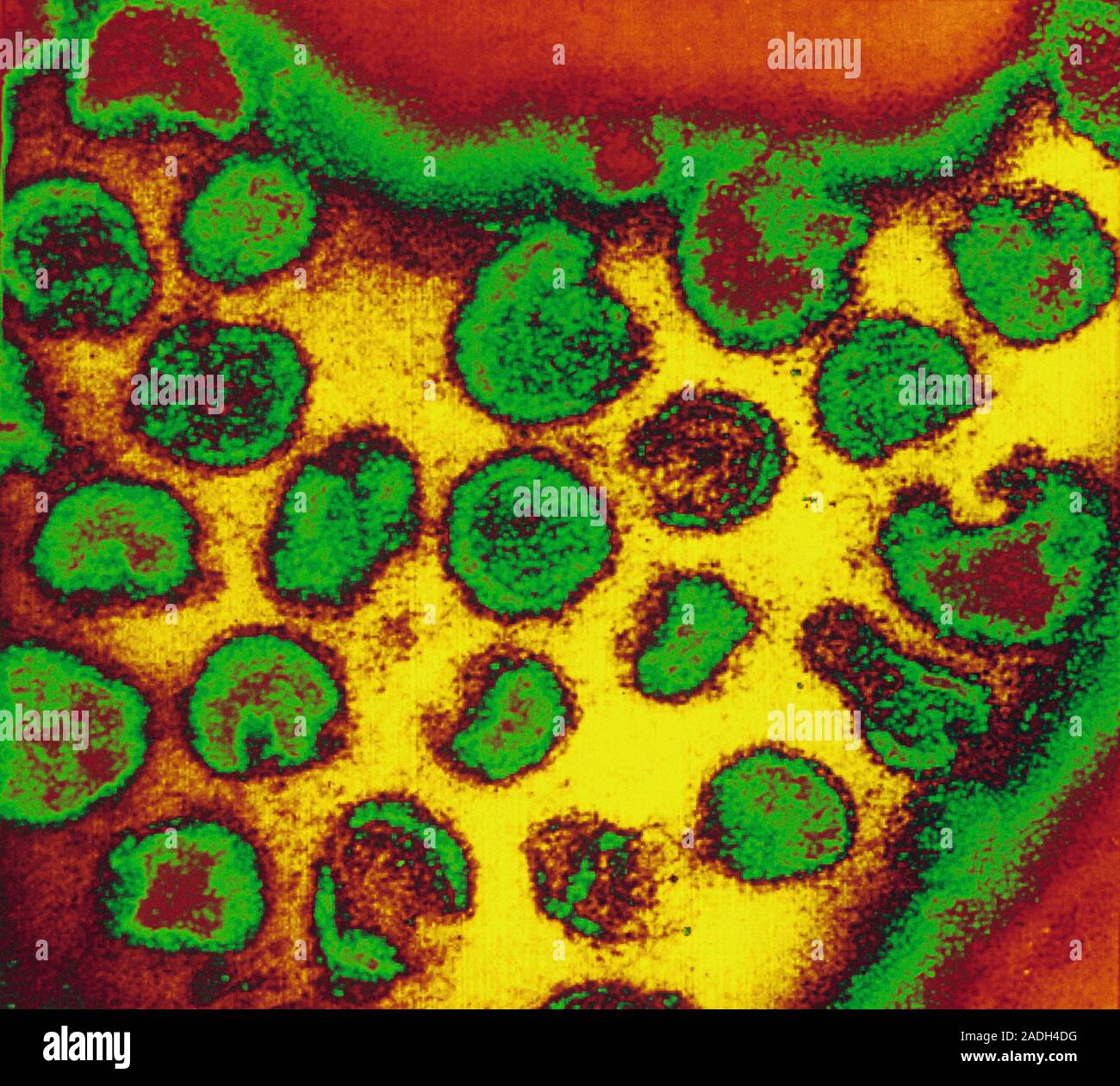 Digitised transmission electron micrograph (TEM) of virions (virus ...