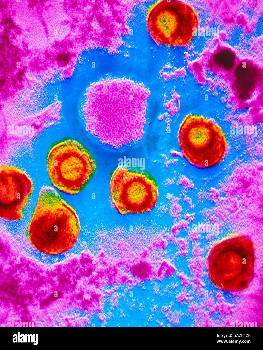 False-colour transmission electron micrograph (TEM) of virions (virus ...