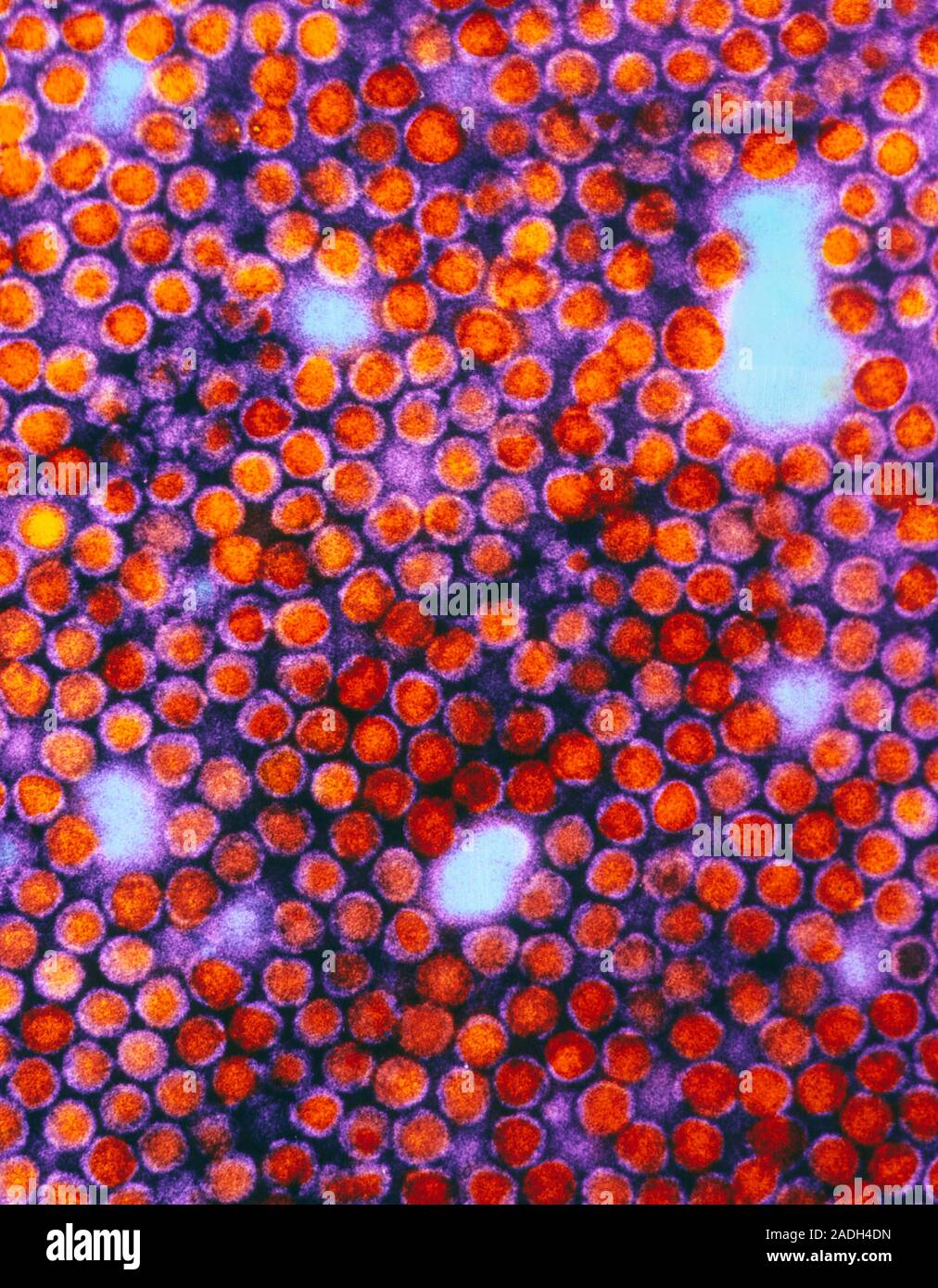 False-colour transmission electron micrograph (TEM) of clustered polio ...