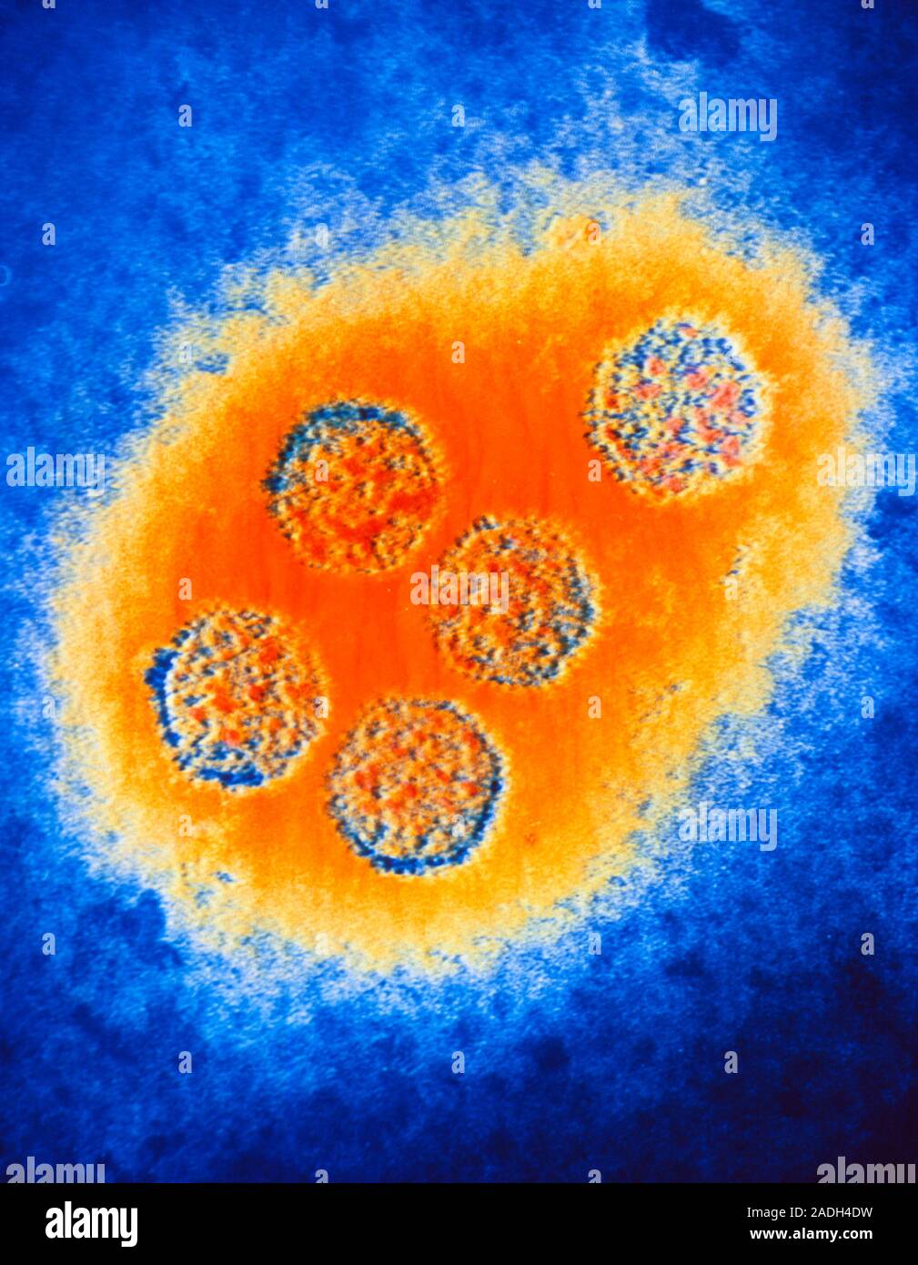 False-colour transmission electron micrograph (TEM) of a group of five ...