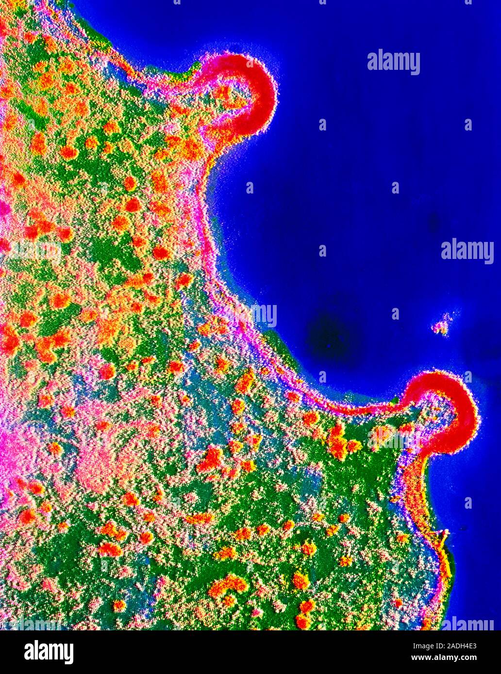 False-colour transmission electron micrograph (TEM) of HIV-1, the AIDS ...