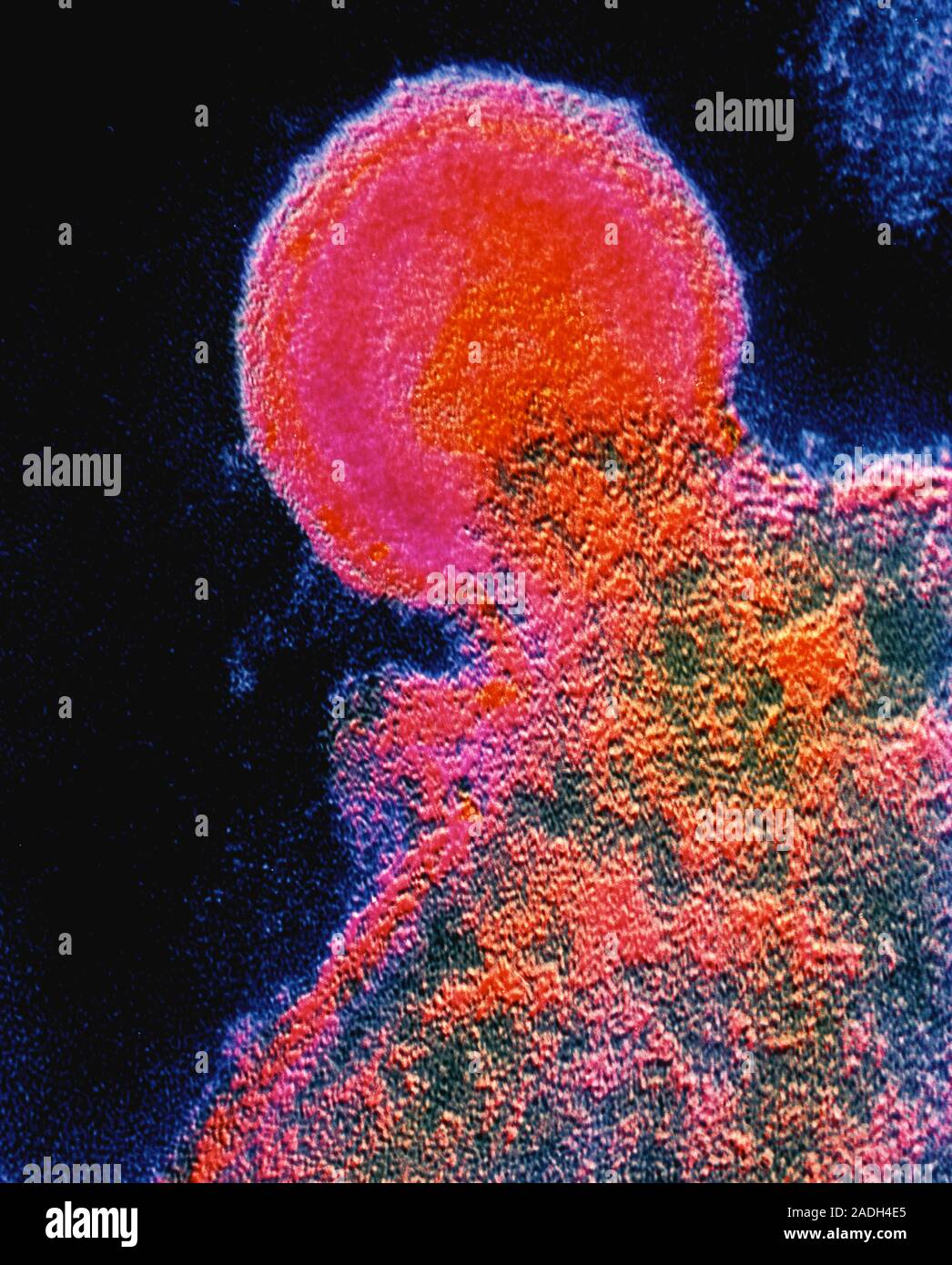False-colour transmission electron micrograph (TEM) of HIV-1, the AIDS ...