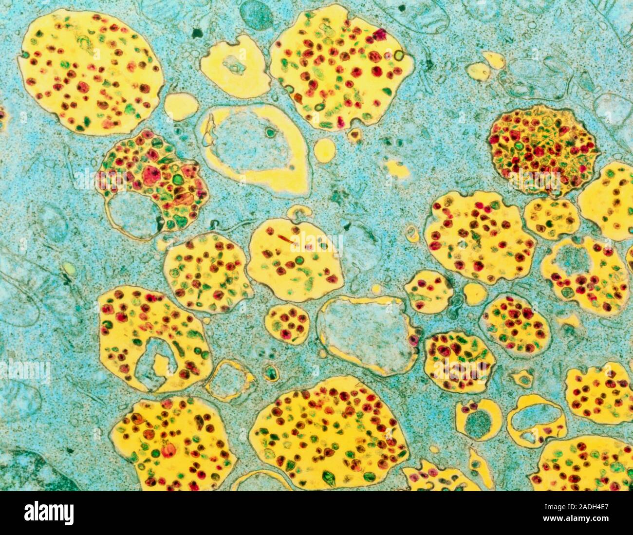 False-colour transmission electron micrograph of a T4 lymphocyte ...