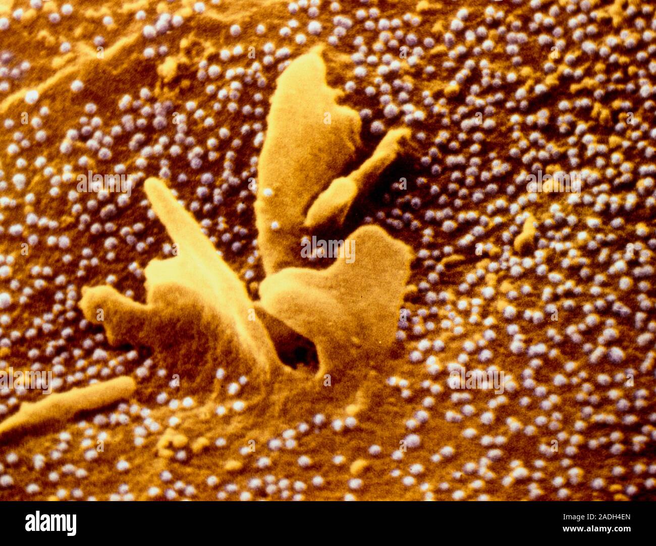 Coloured scanning electron micrograph of rubella viruses (dots ...