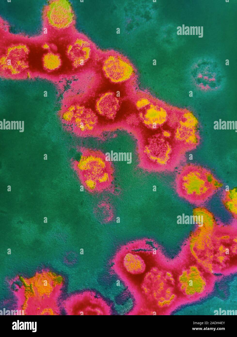 Coloured transmission electron micrograph of virions (virus particles ...