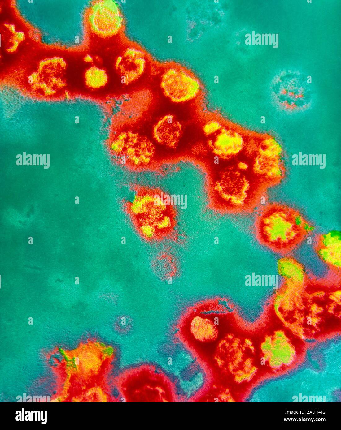 Coloured transmission electron micrograph of virions (virus particles ...