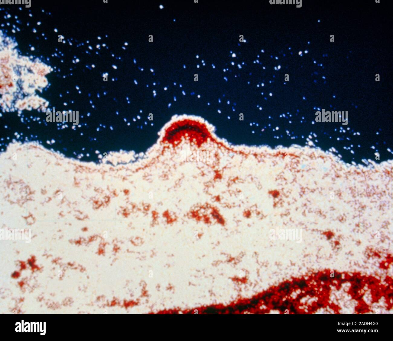 HIV virus. Colour transmission electron micrograph of an HIV virus (at ...