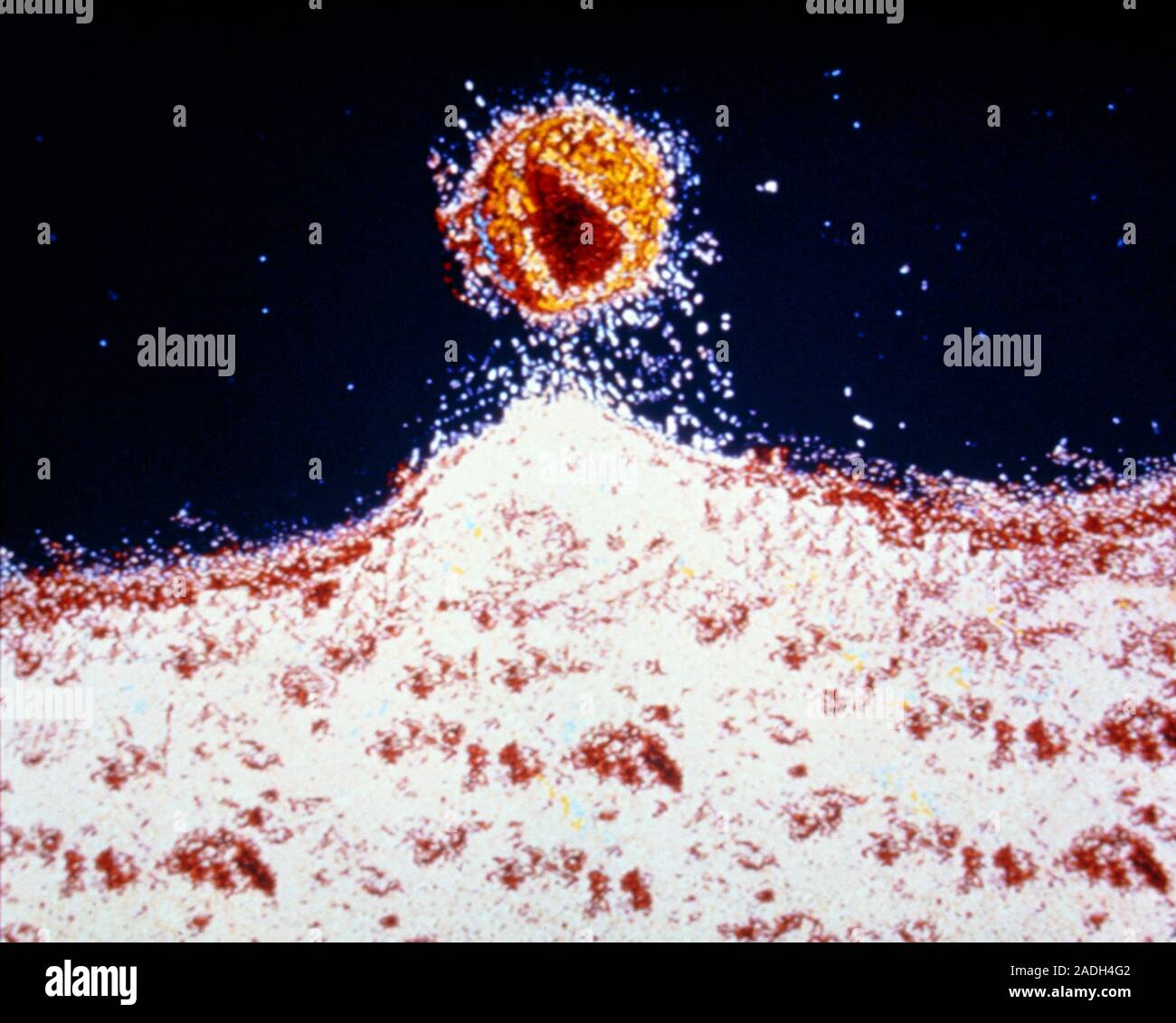 HIV virus. Coloured transmission electron micrograph of an HIV virus ...