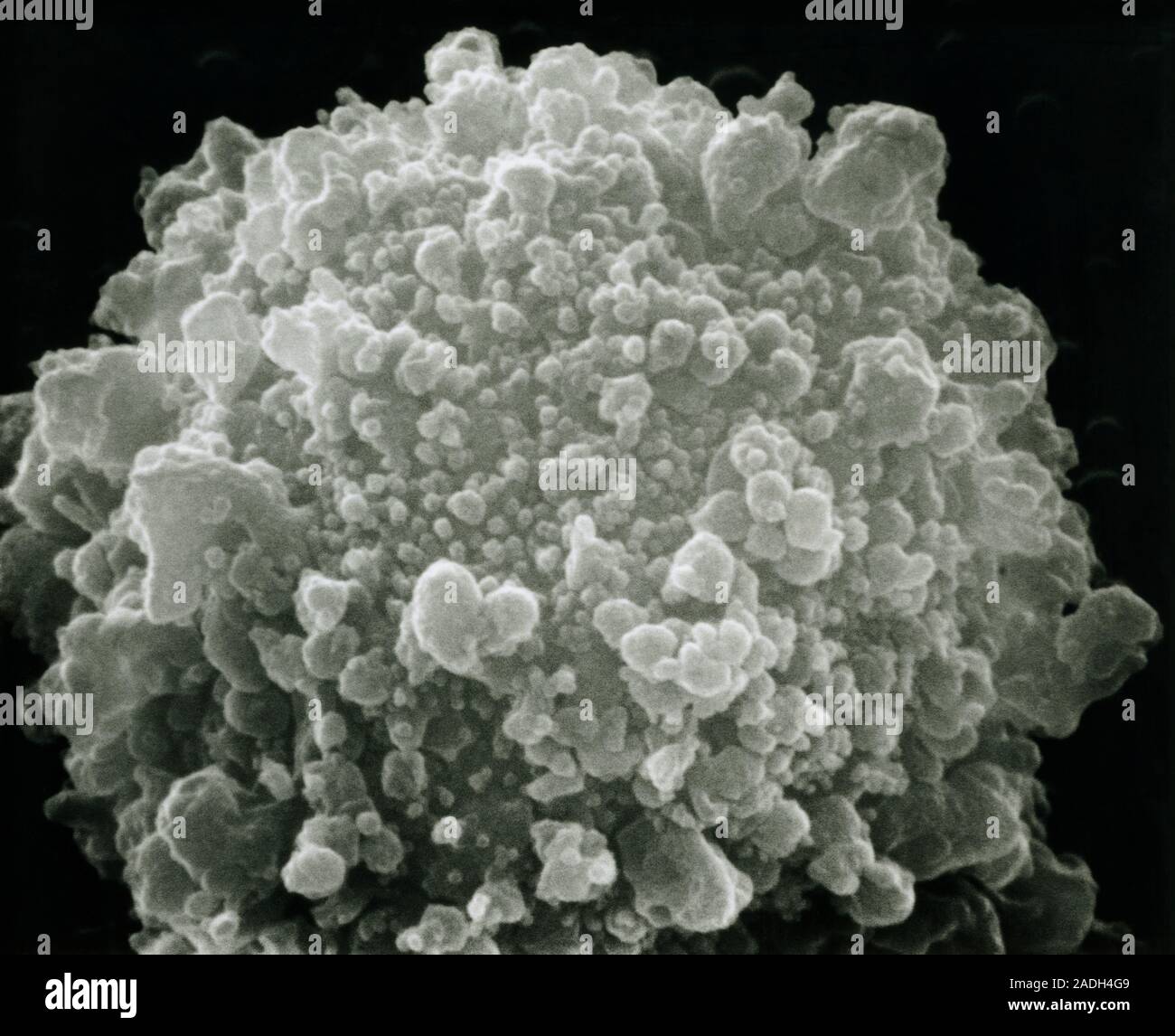 AIDS viruses. Scanning electron micrograph (SEM) of a T-lymphocyte ...