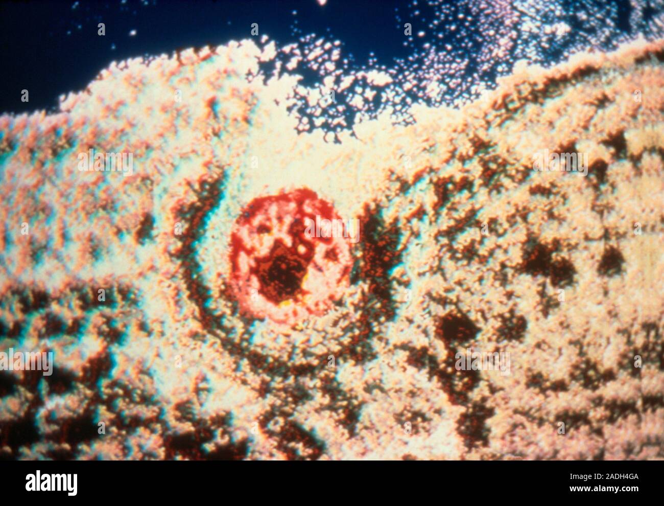 HIV virus. Coloured transmission electron micrograph of an HIV virus ...