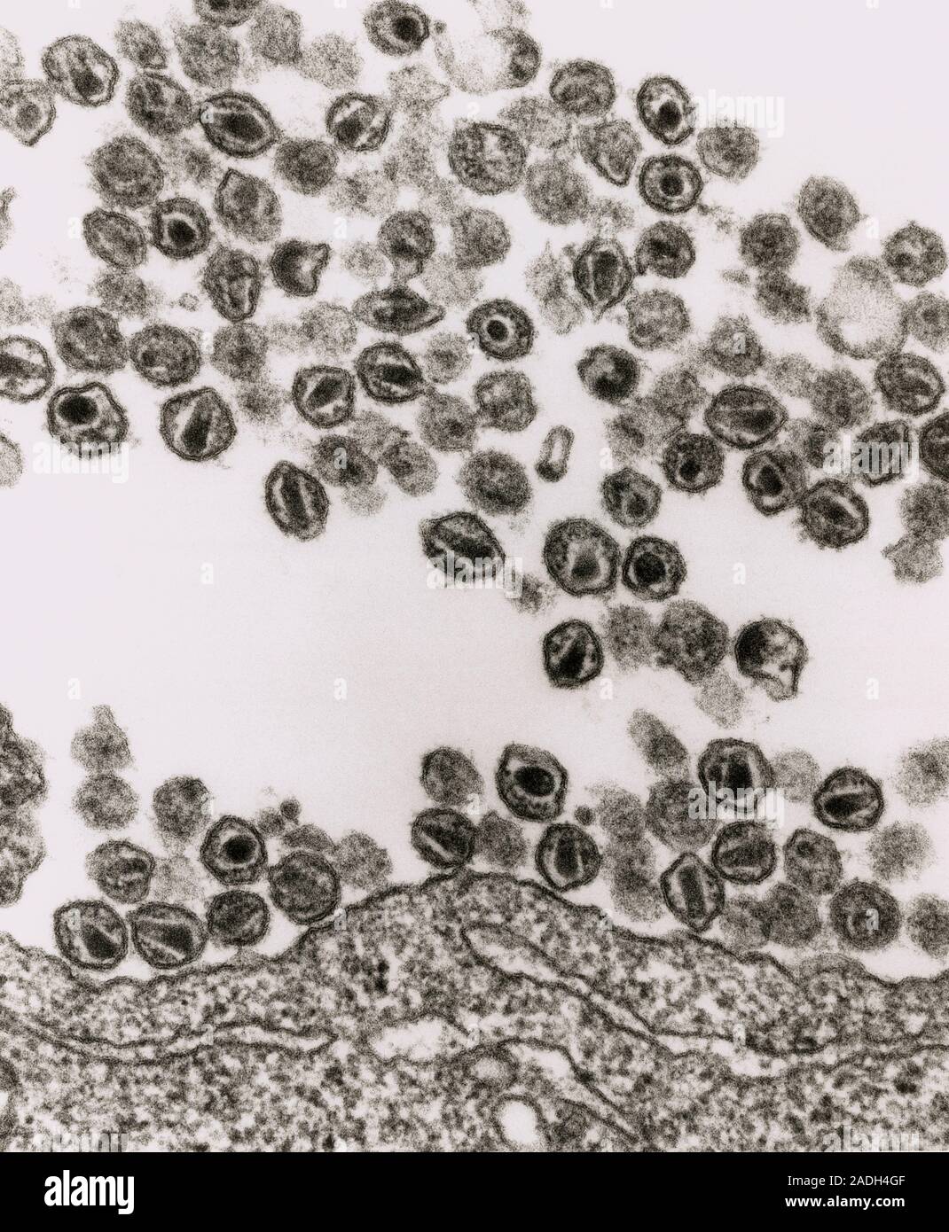AIDS virus. Transmission electron micrograph (TEM) of a T-lymphocyte ...