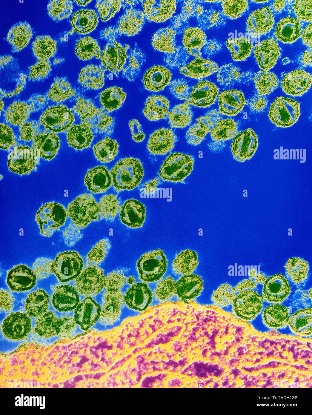 AIDS virus. Coloured Transmission electron micrograph of a T-lymphocyte ...