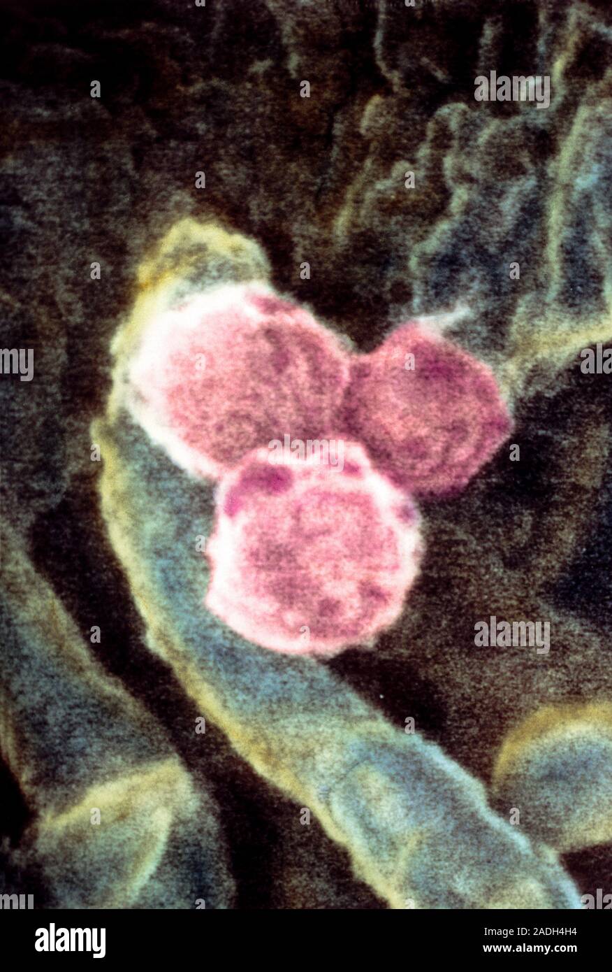 AIDS virus. Coloured scanning electron micrograph (SEM) of Human ...