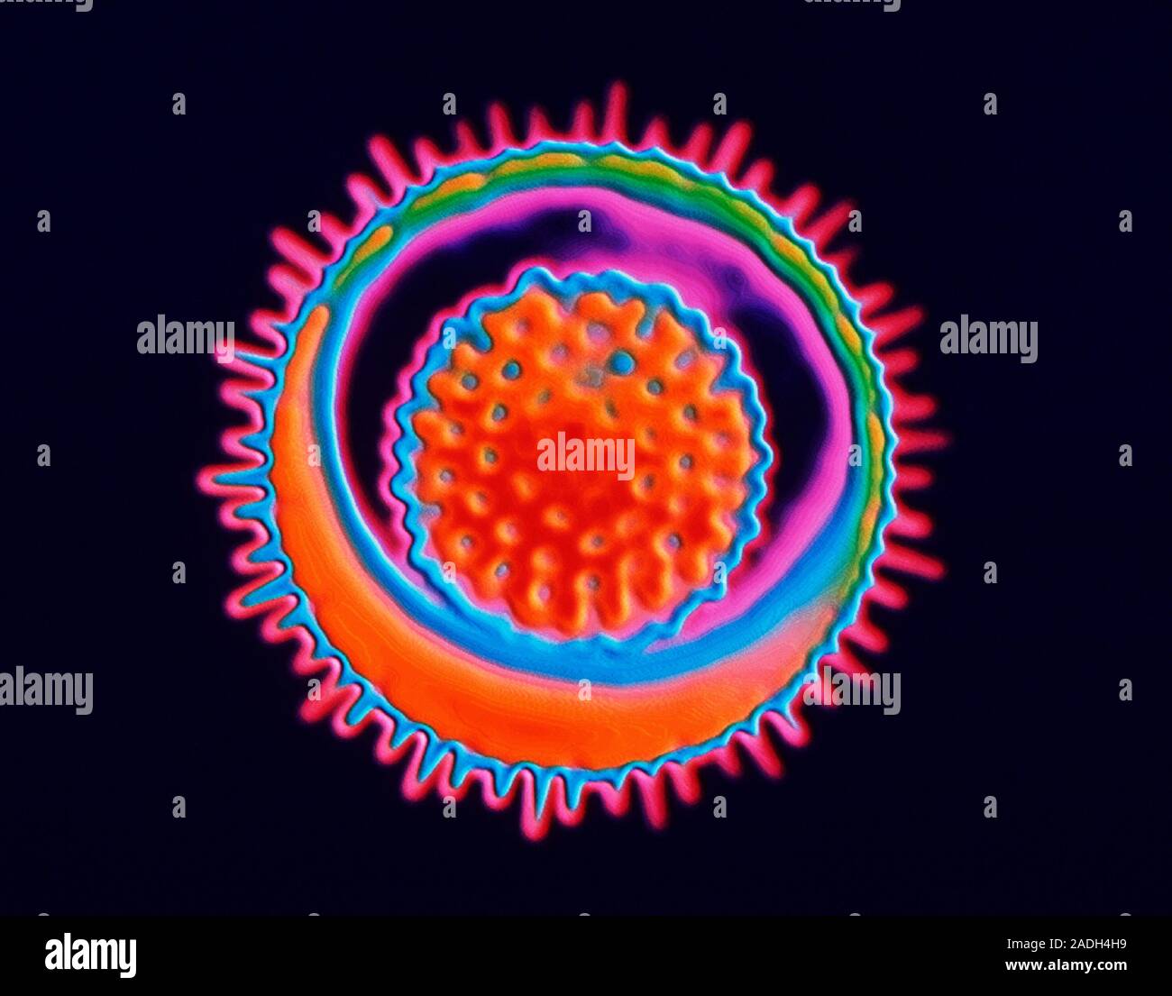 Herpes simplex virus. Coloured transmission electron micrograph (TEM ...