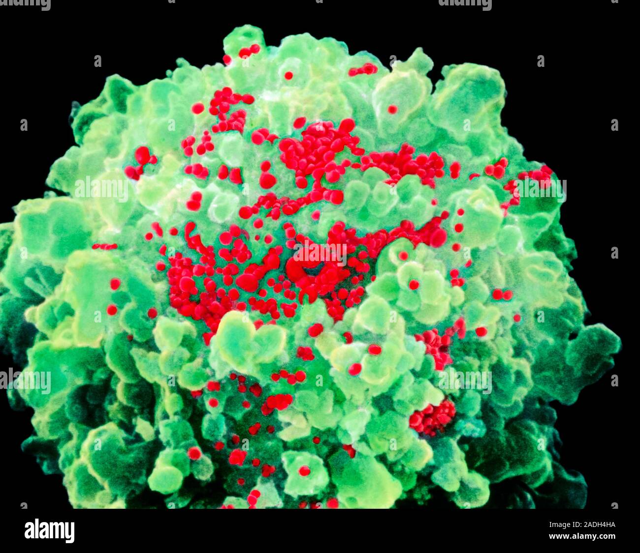 AIDS viruses. Coloured scanning electron micrograph of a T-lymphocyte ...