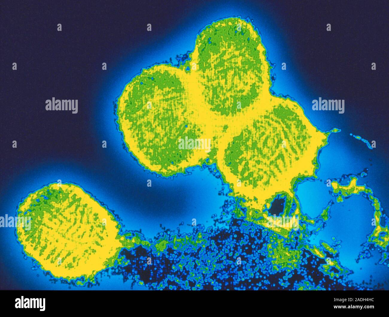 Smallpox virus. Coloured transmission electron micrograph (TEM) of ...