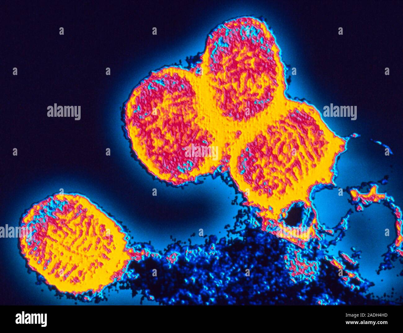 Smallpox virus. Coloured transmission electron micrograph (TEM) of ...
