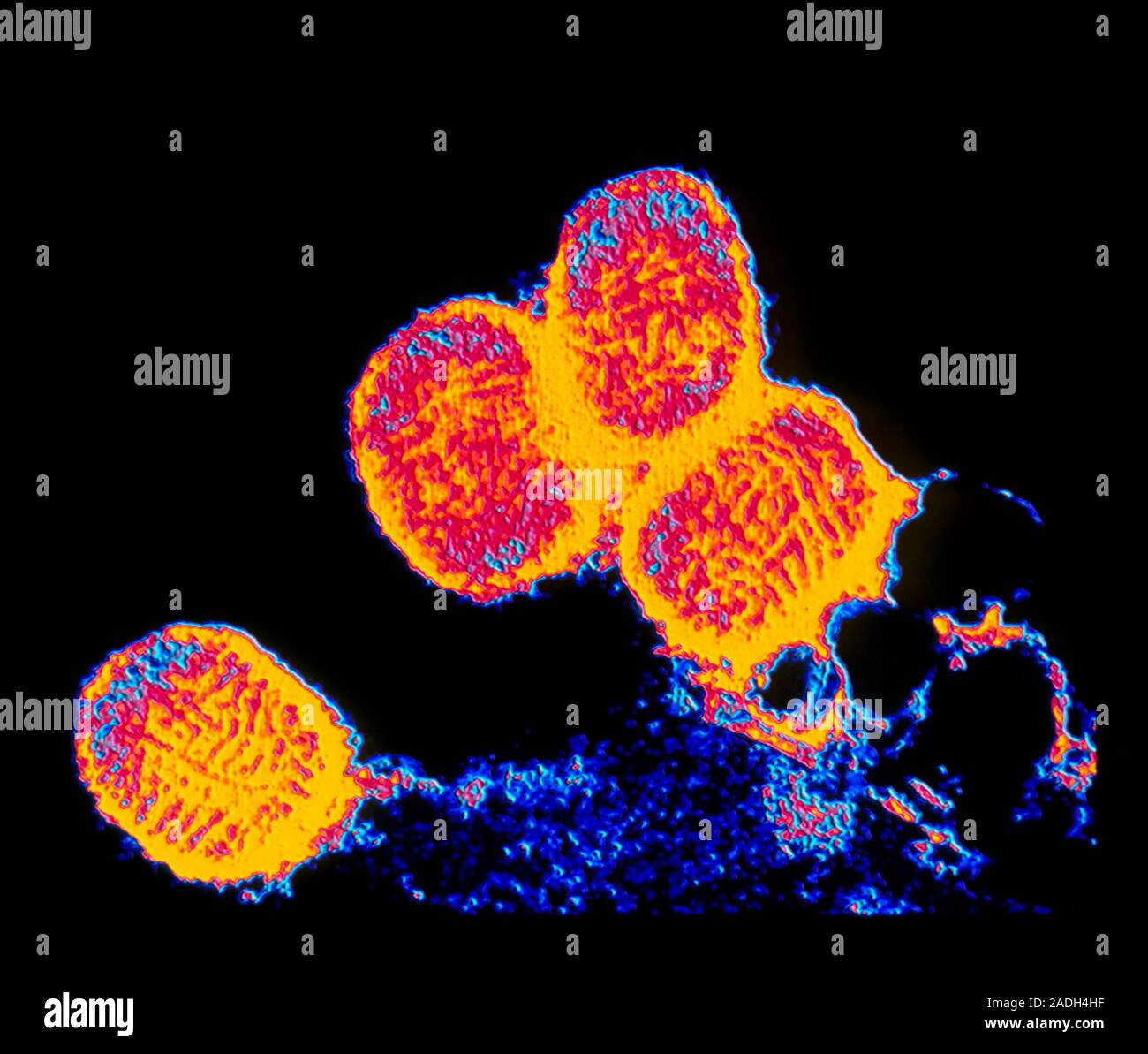 Smallpox virus. Coloured transmission electron micrograph (TEM) of ...