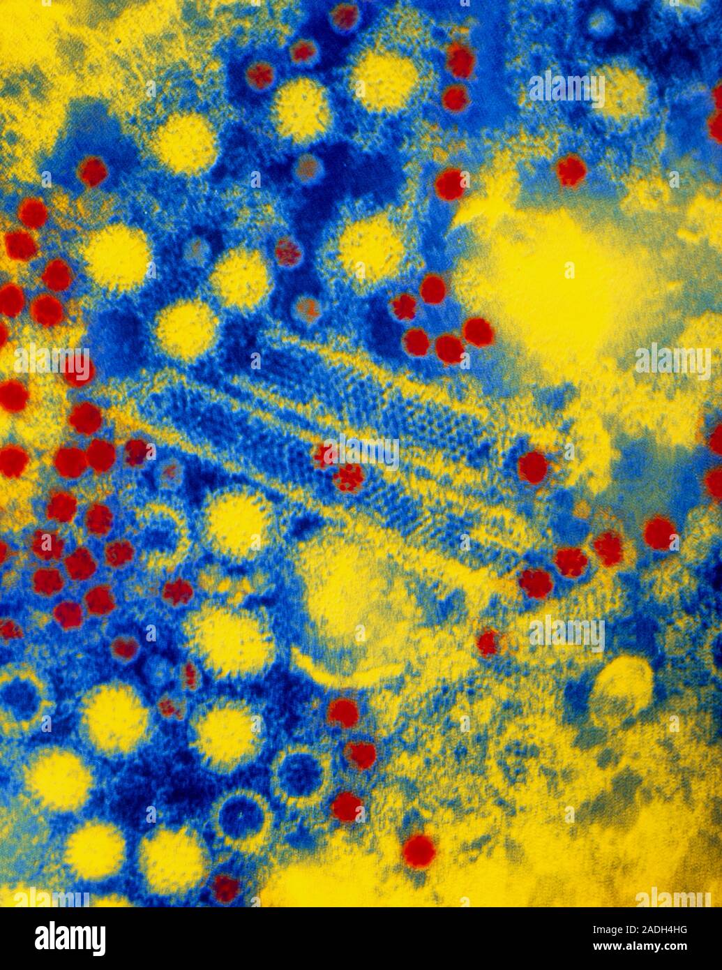 Viruses causing diarrhoea. Coloured transmission electron micrograph of ...