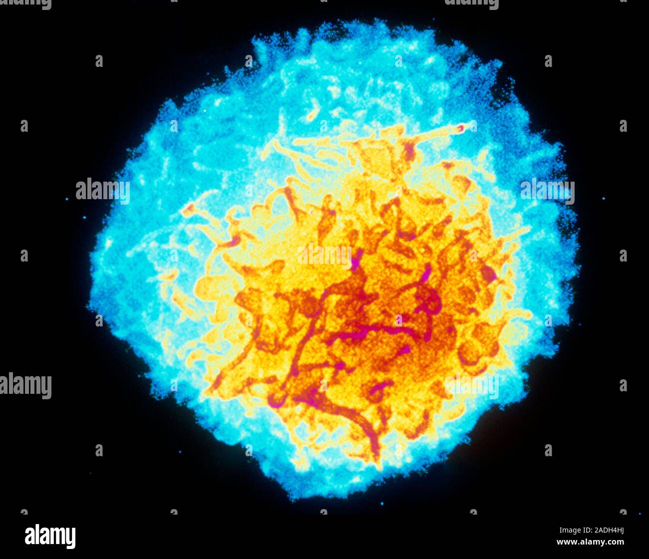 HIV infected T-cell. Coloured Scanning Electron Micrograph (SEM) of a T ...