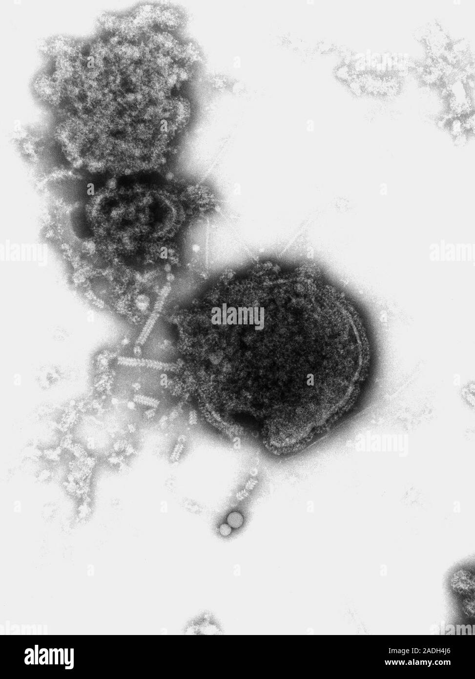 Measles virus. Transmission electron micrograph (negative stain) of a ... Measles virus. Transmission electron micrograph (negative stain) of a ...