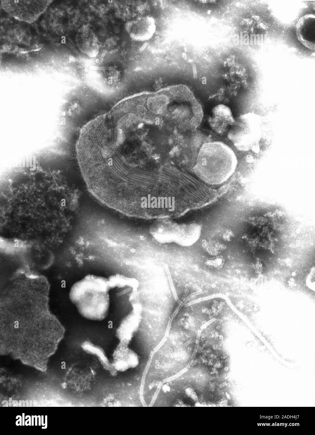 Measles virus. Transmission electron micrograph (negative stain) of a ...